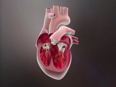 Artract Medical Inc - Artract Medical Inc